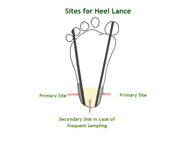 Sterile SteriHeel Plus Pediatric Lancet for Heel Incision, Box of 50