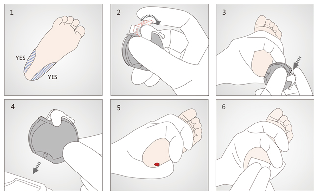 Sterile SteriHeel Plus Pediatric Lancet for Heel Incision, Box of 50