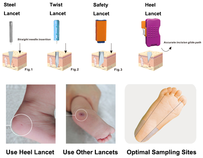 Heel Blade Safety Lancet for Newborn Capillary Blood Collection